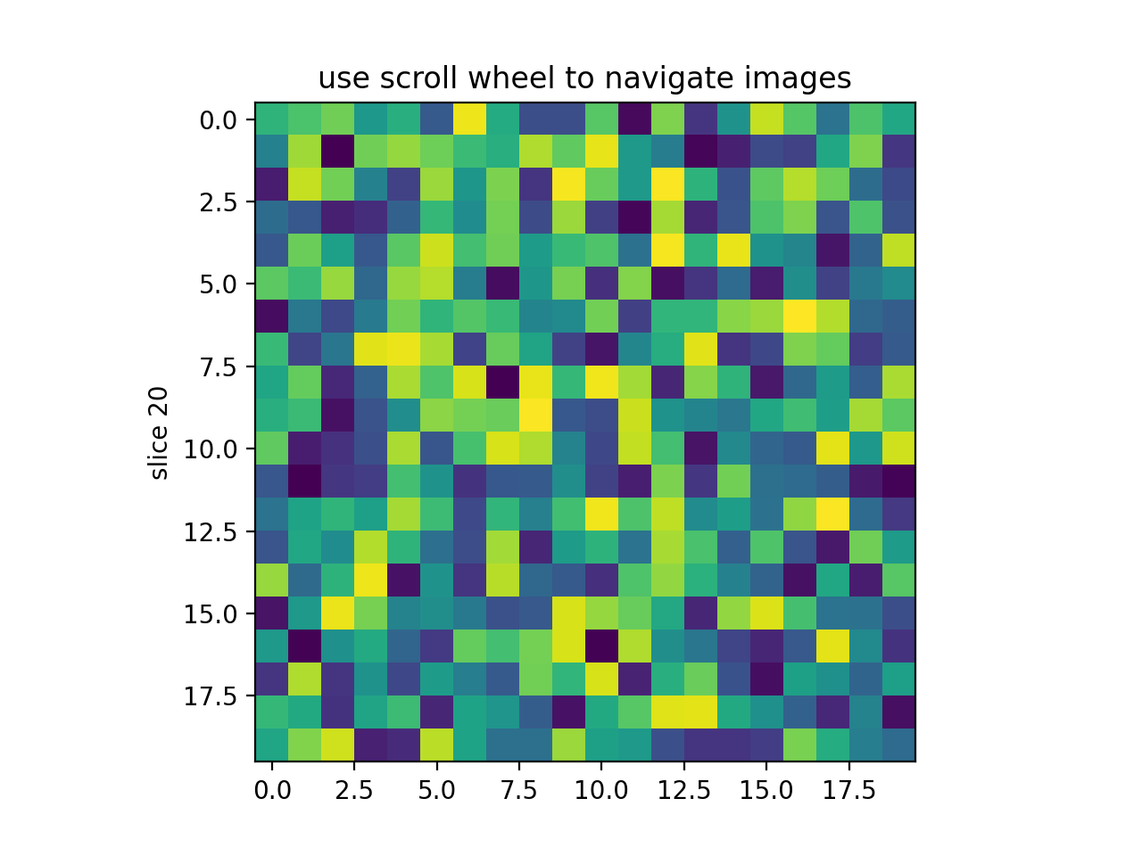 Visor de cortes de imagen_Visualización de Python matplotlib