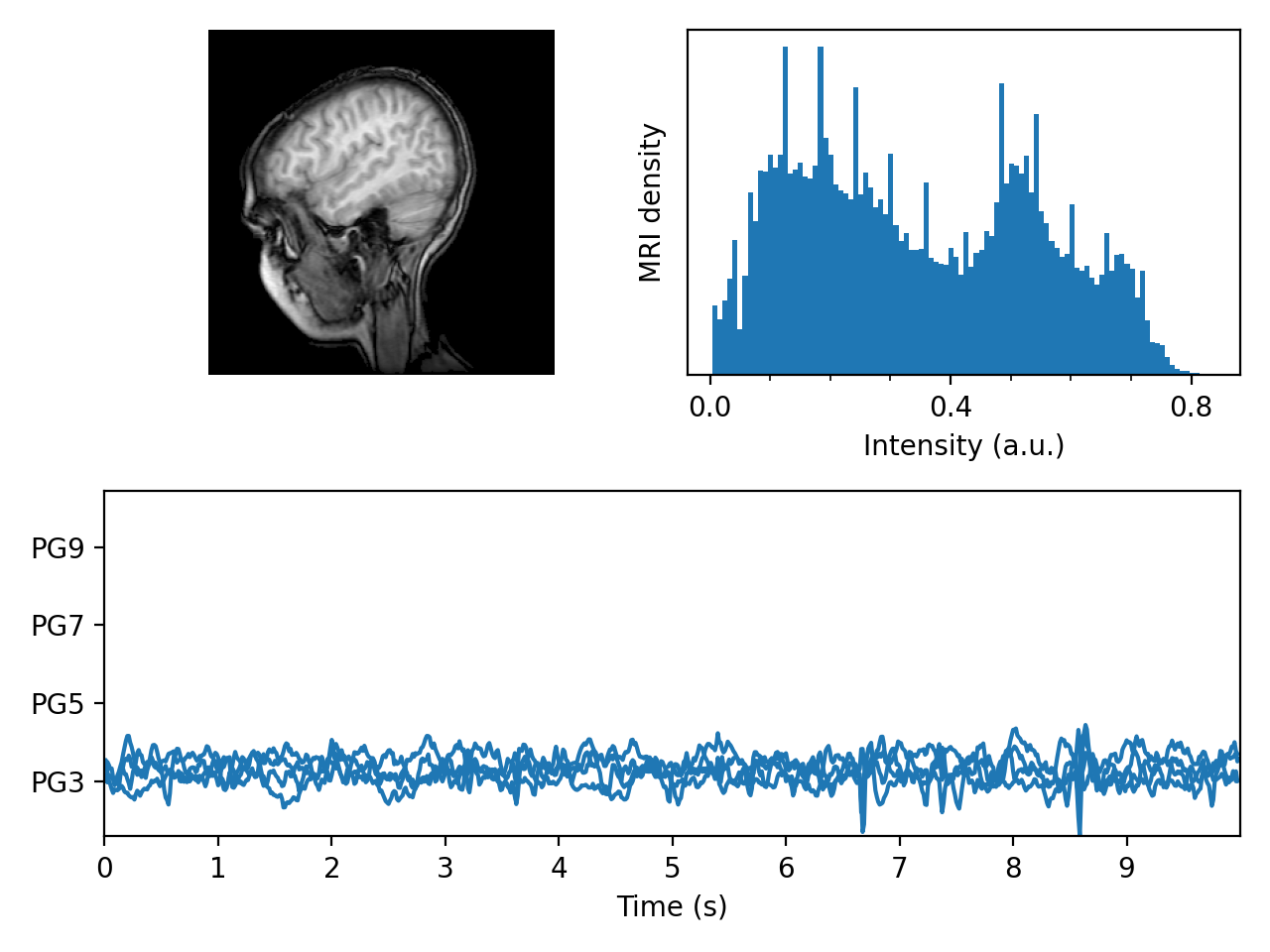 RM con EEG_Visualización de Python matplotlib